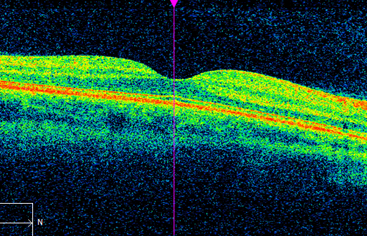 The Latest in Optometry Technology - Eyecare Associates of Lee’s Summit
